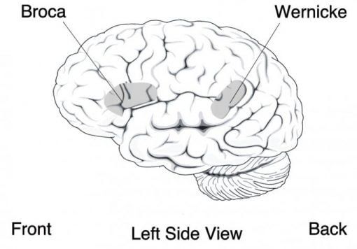 Aphasie (de Broca, de Wernicke) : définition, symptômes, traitements ...